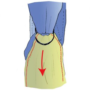 PREPARATION - P-sling New York